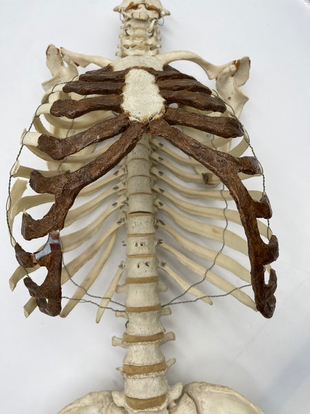A Real Human Skeleton Torso – 6 Brains