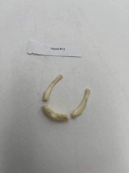 Real Human Hyoid Bone #13 – 6 Brains