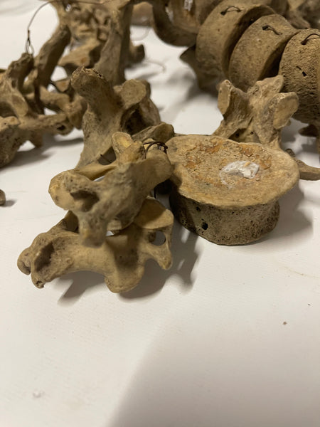 Antique Real Human Skeleton Spine Vertebral Column with Pelvis ARHS60 ...