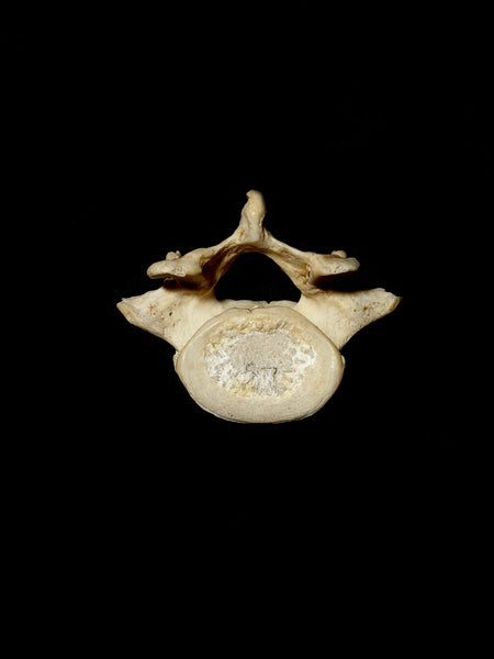 Real Human Lumbar Vertebrae – 6 Brains