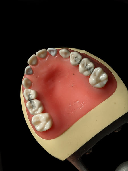 Pediatric Dental Model With Fillings And Caps – 6 Brains